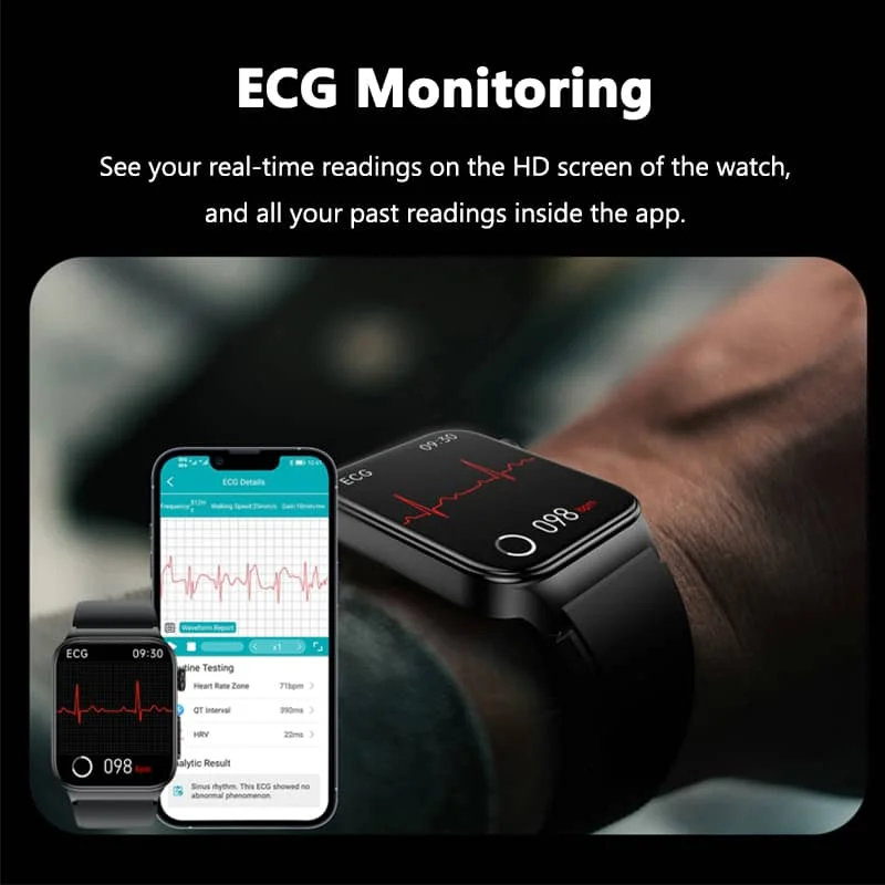 ECG Smart Watch with Blood Pressure Monitor Body Temperature Blood Glu ...